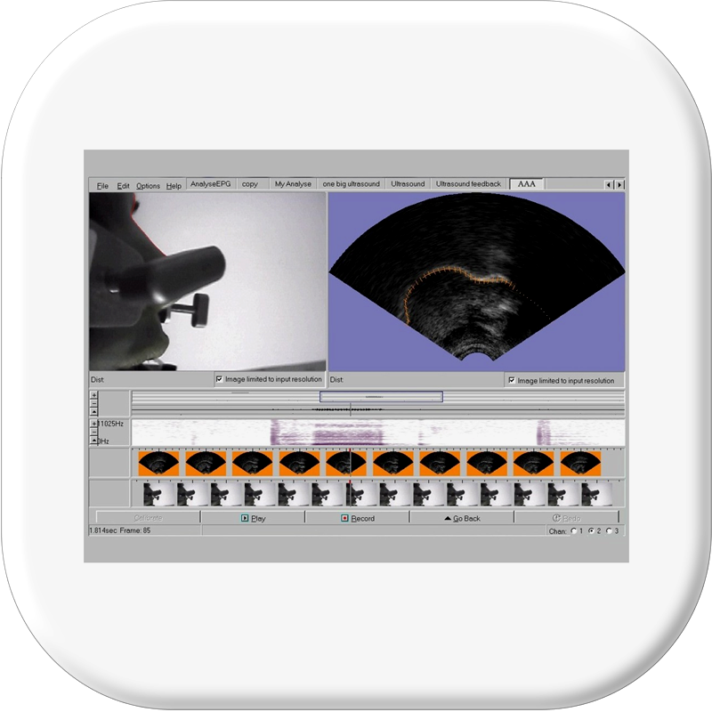 Articulate Instruments Ltd